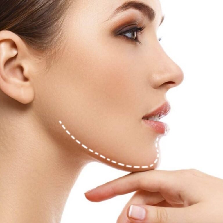 Perfilado de Mandíbula - Tabatha Clínica Estética